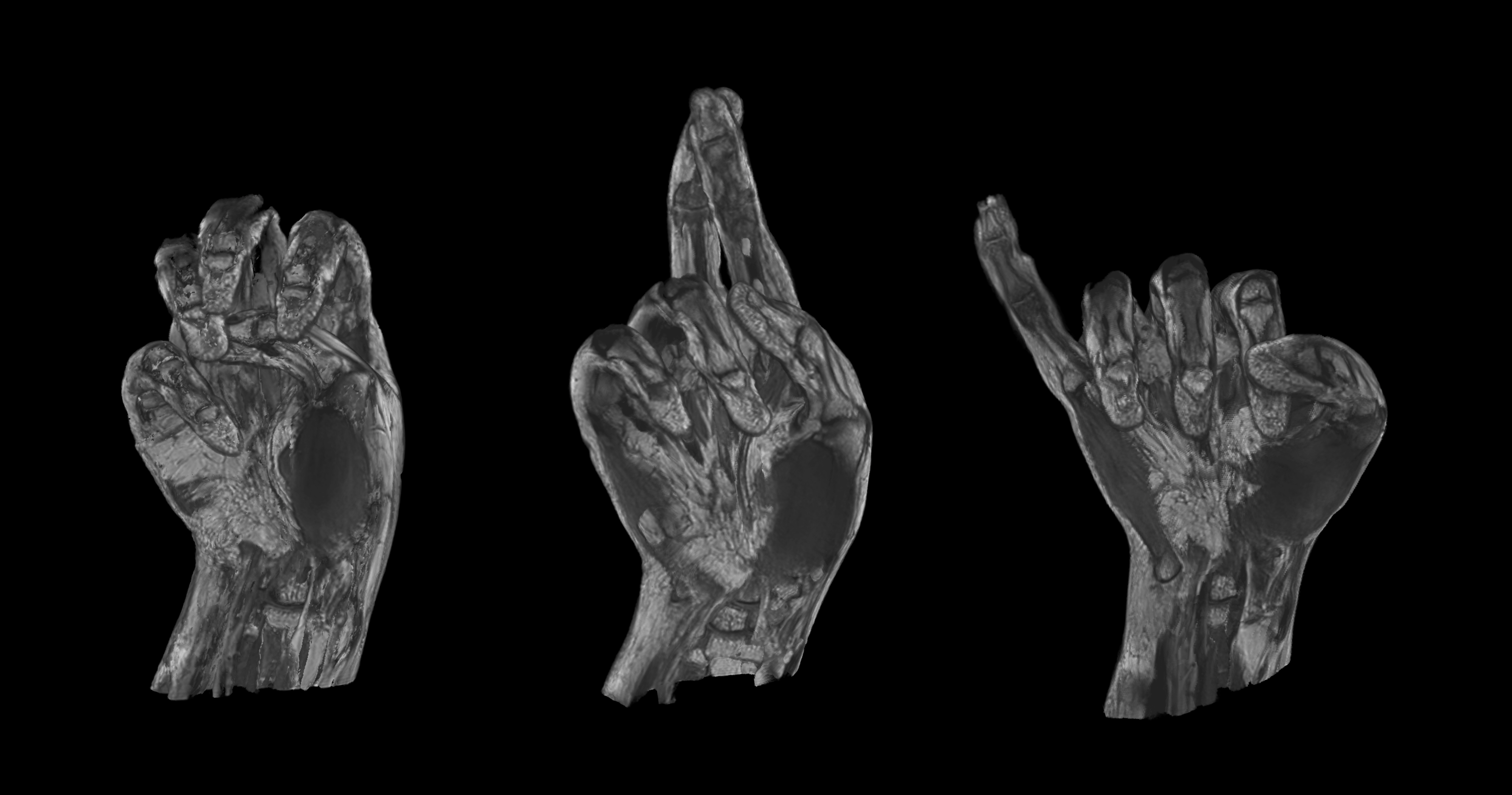 MRI detectors that fit like a glove | Research Communities by Springer ...