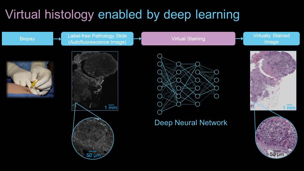 Deep learning-based virtual histology staining of unlabelled tissue ...