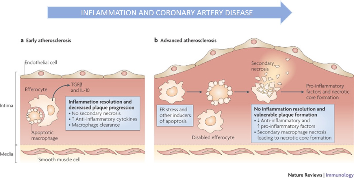 Stent technology in the treatment of coronary artery disease | Research ...