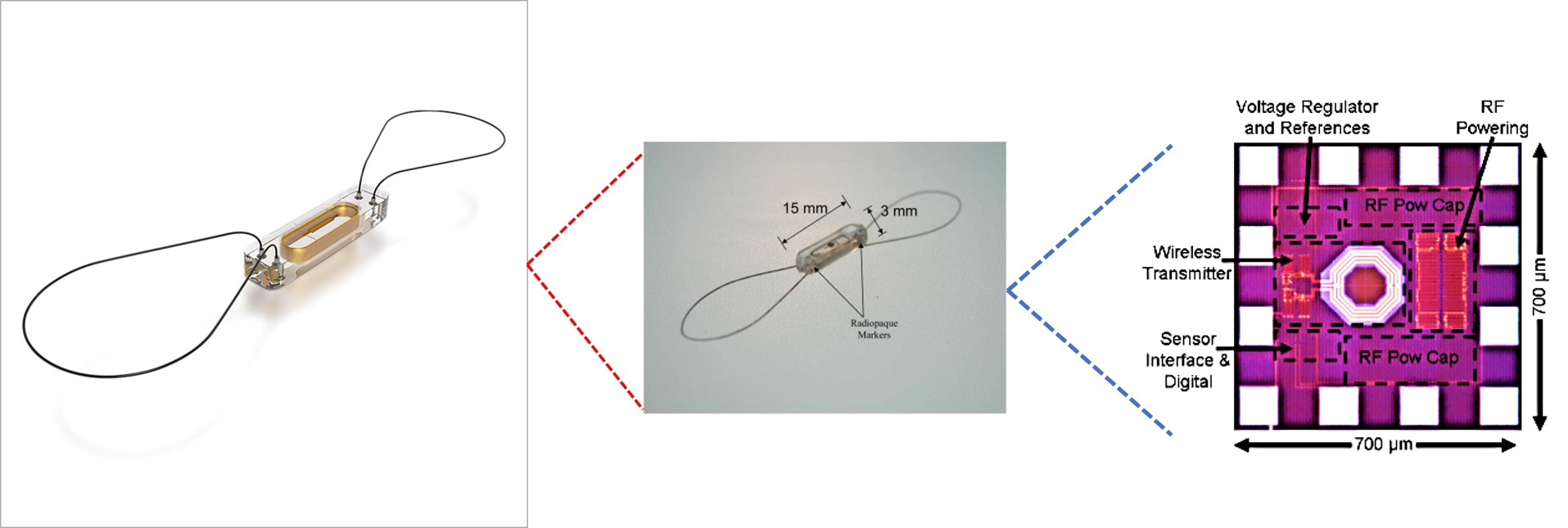 Wireless Implant Technology in Medicine | Research Communities by ...