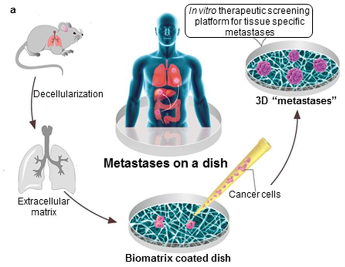 Tissue engineering of cancer metastasis on a dish | Research ...