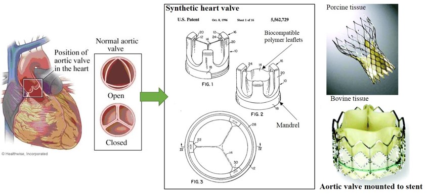 Engineering heart valves | Research Communities by Springer Nature