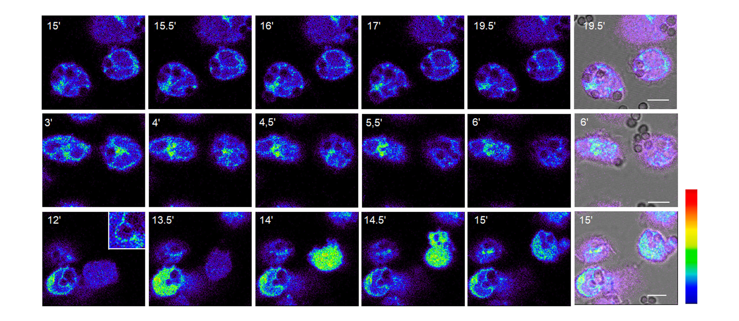 Calcium binding by fungal melanin has essential immunological function ...
