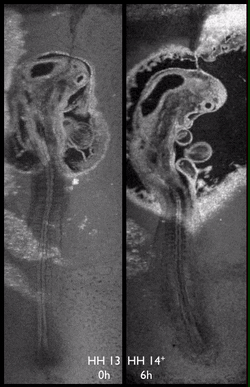 Visualizing embryonic heart formation in real time: | Research ...