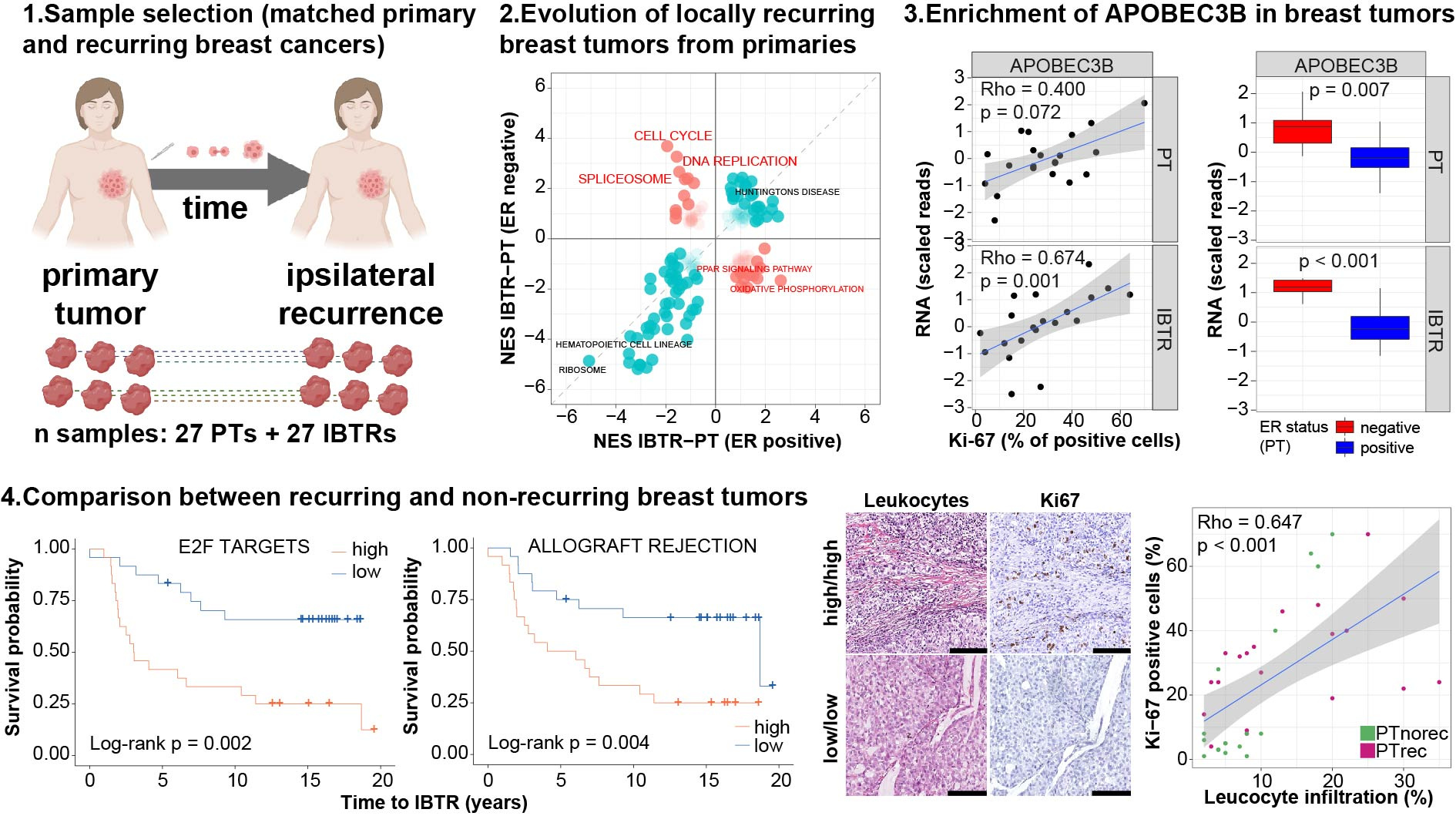 Proteogenomics decodes the evolution of human ipsilateral breast cancer ...