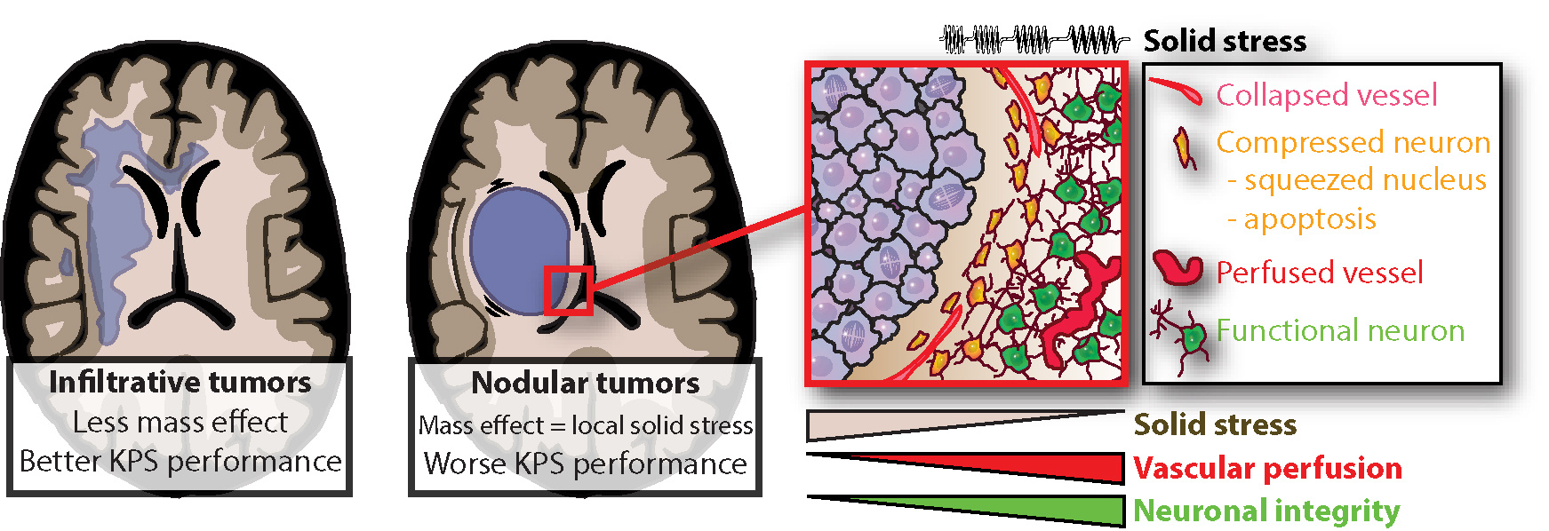 Brain tumor-generated solid stress impairs vessel perfusion and ...
