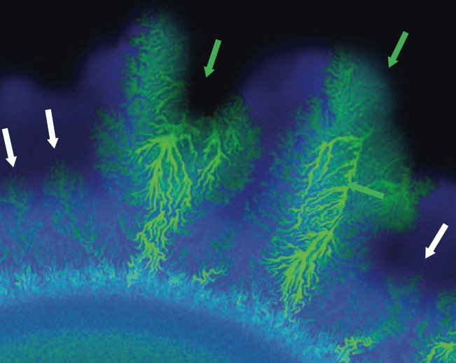 Pattern diversification during microbial spatial self-organization ...