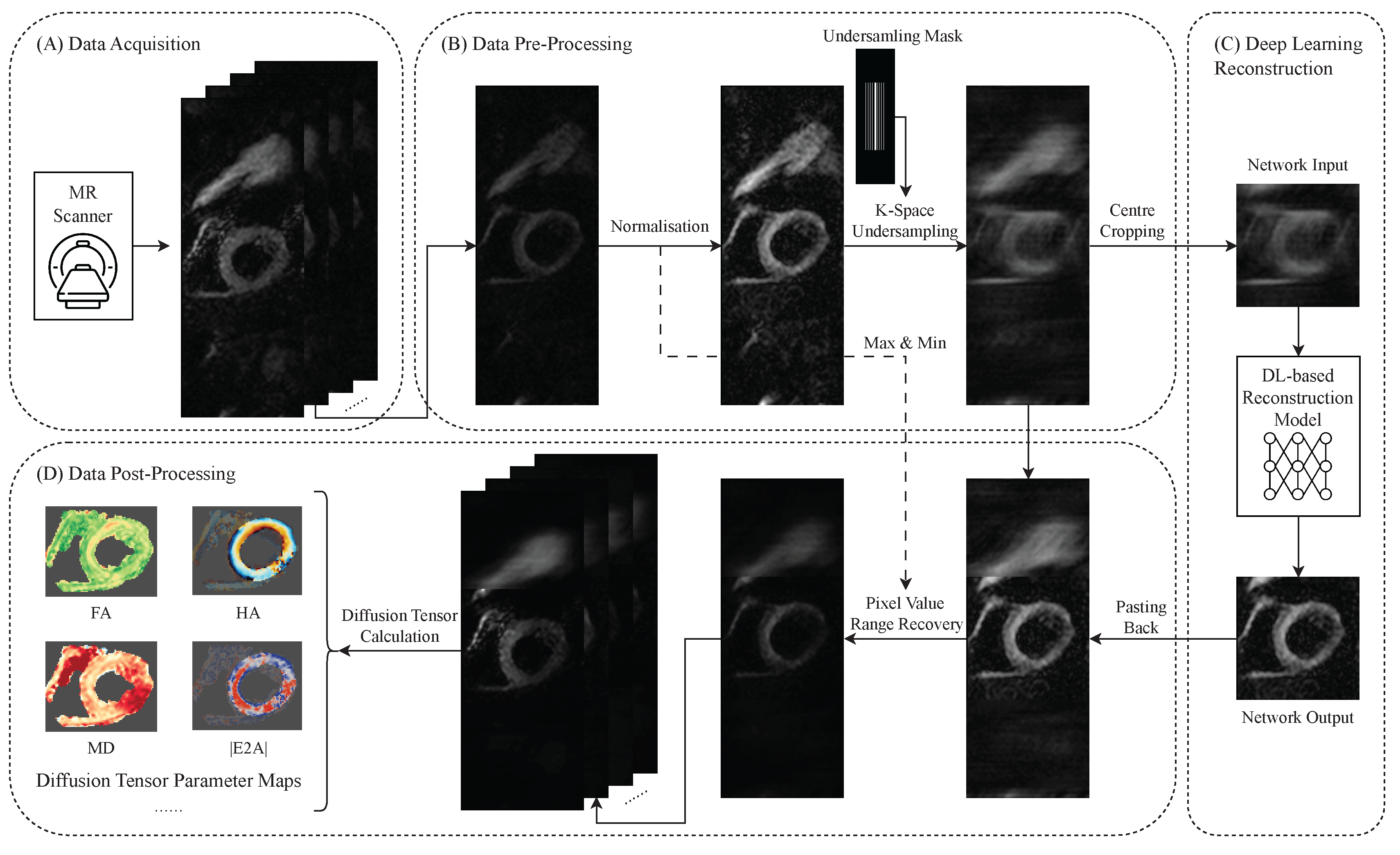 Exploring the Potential of Deep Learning in Cardiac Diffusion Tensor ...