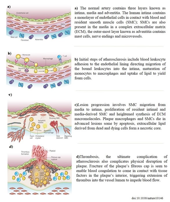 The virtual physiology of the human artery | Research Communities by ...