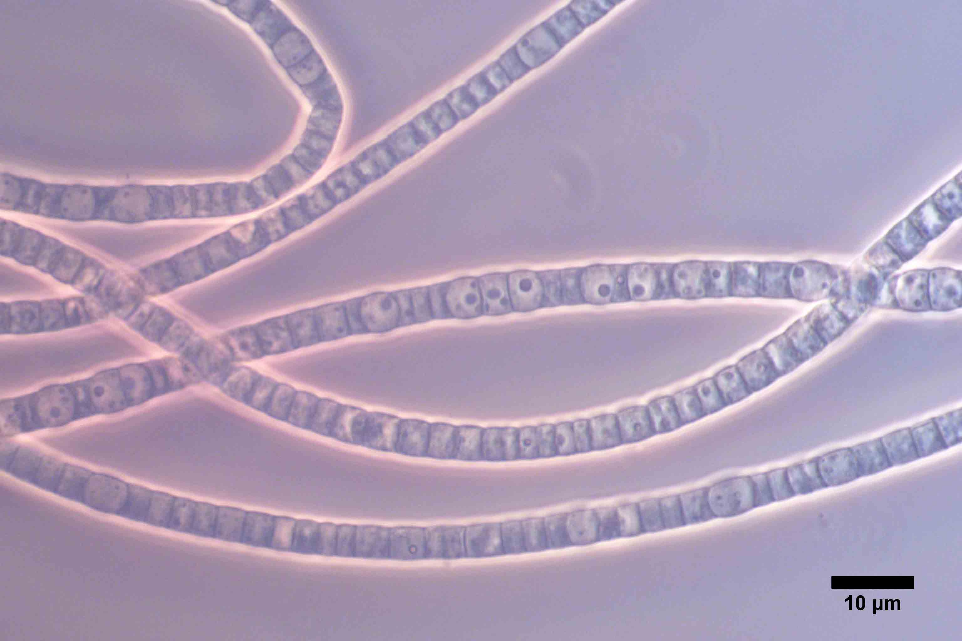 Cable bacteria: Living electrical wires with record conductivity ...