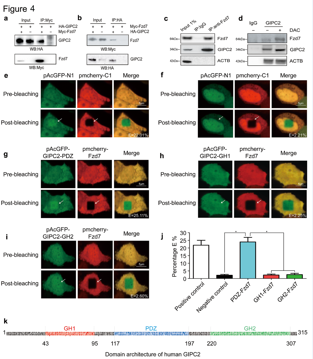 GIPC2 interacts with Fzd7 to promote prostate cancer metastasis by ...