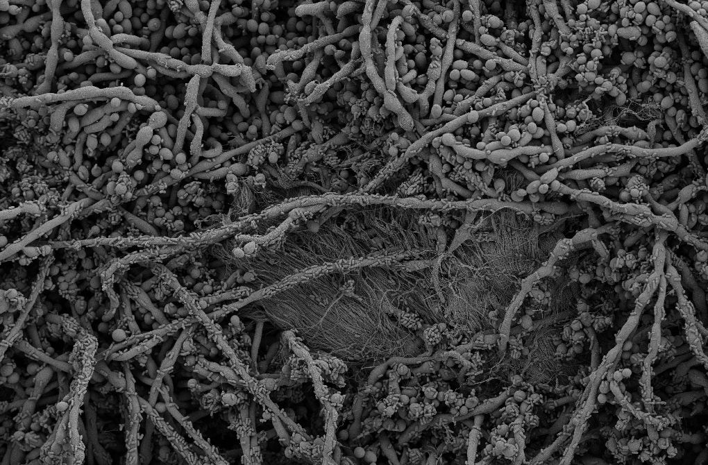 Fungal-bacterial biofilm assembly | Research Communities by Springer Nature