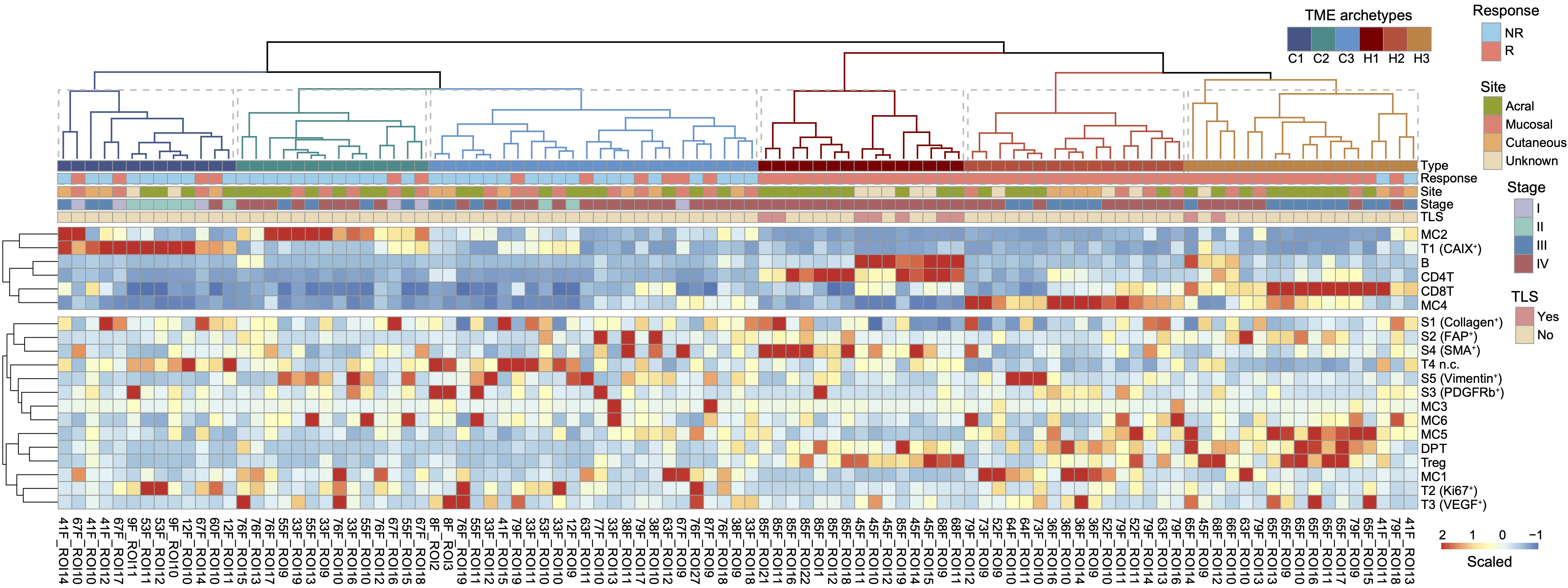 A step towards understanding the tumor immune microenvironments ...