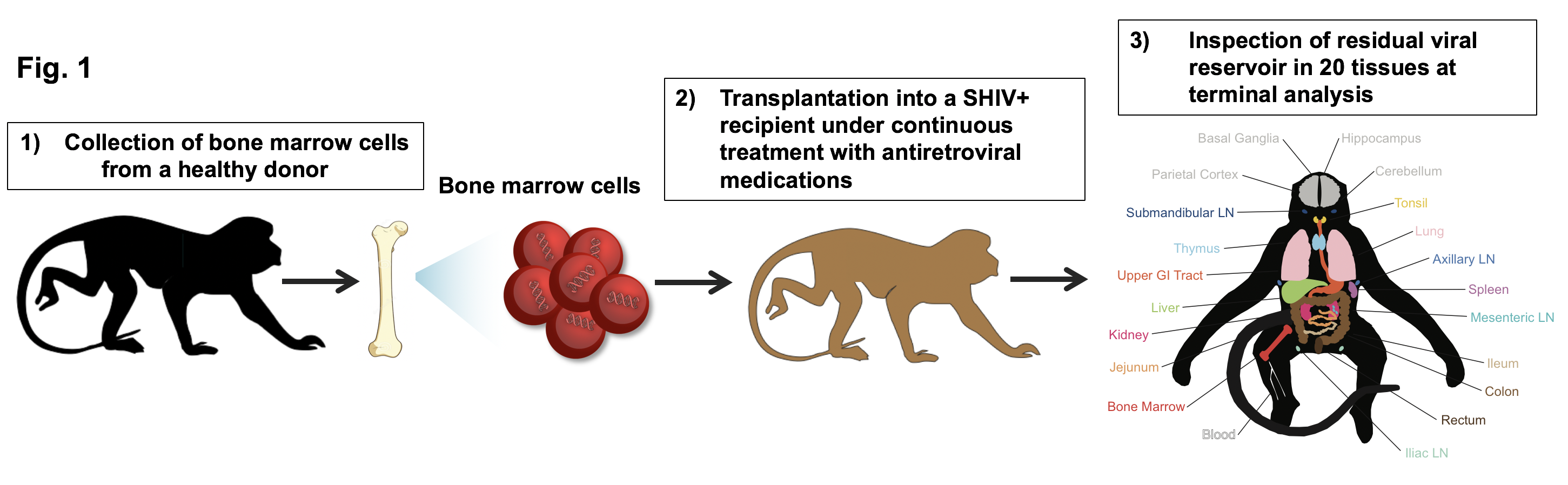 Modeling and Understanding the Biology of Transplant-Mediated HIV Cure ...