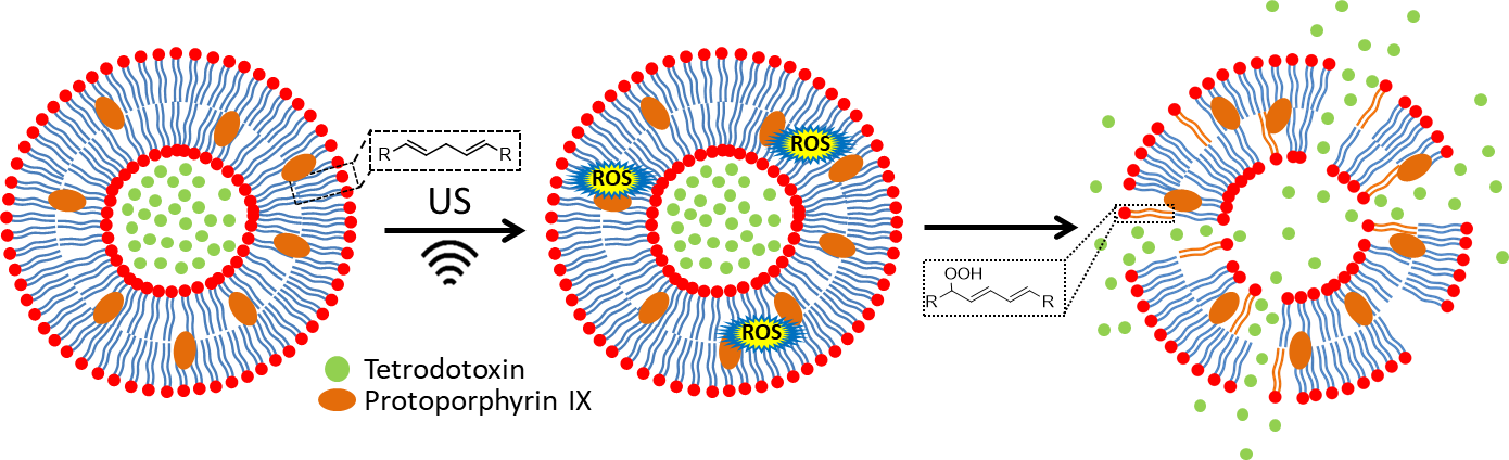 Ultrasound-triggerable local anaesthesia | Research Communities by ...