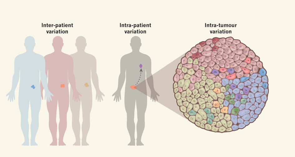 Visualizing intratumoral heterogeneity: a dream come true! | Research ...