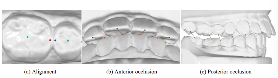 A 3D dental model dataset with pre/post-orthodontic treatment for ...