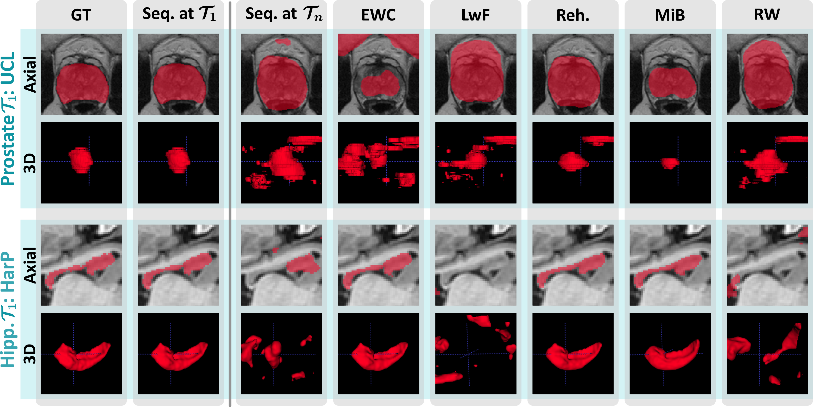 Lifelong nnUNet | Research Communities by Springer Nature