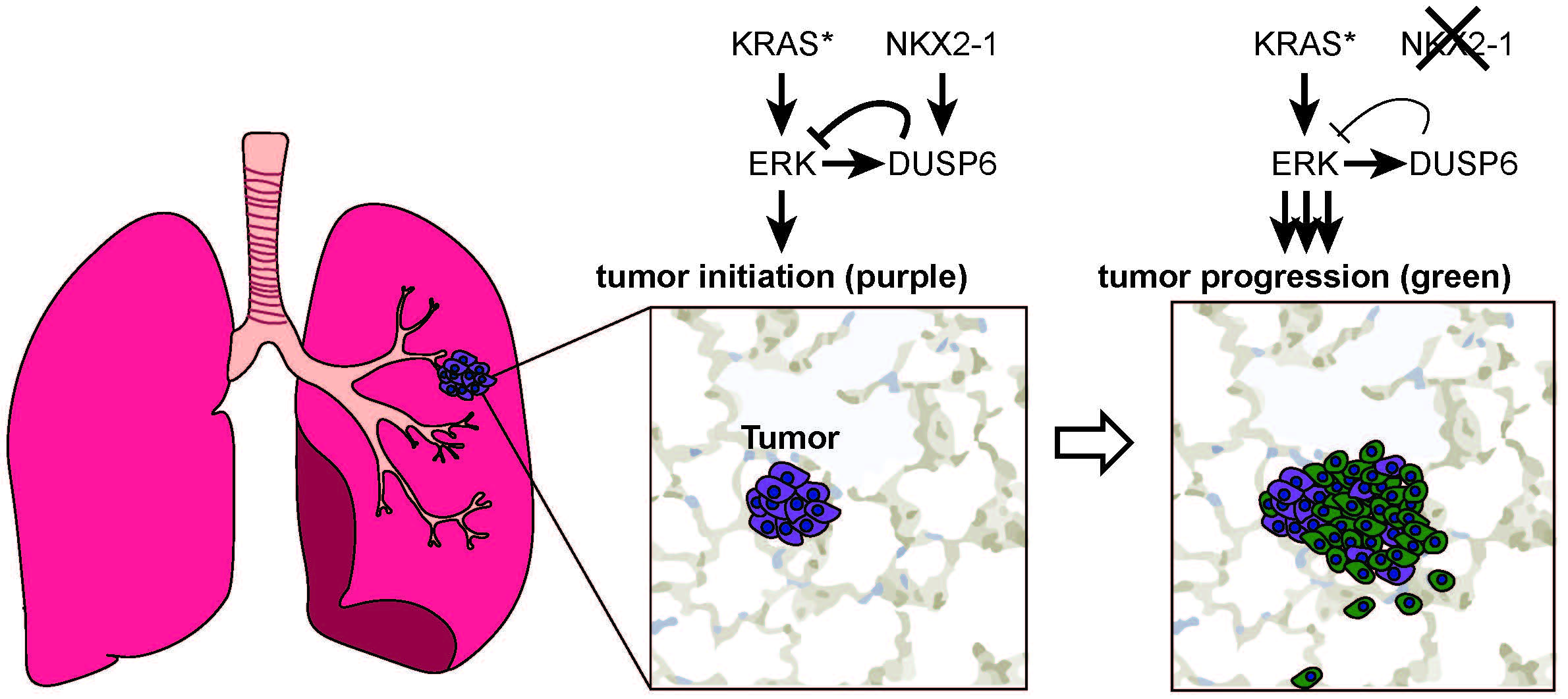 A negative NKX2-1/DUSP6/ERK signal inhibits lung cancer | Research ...