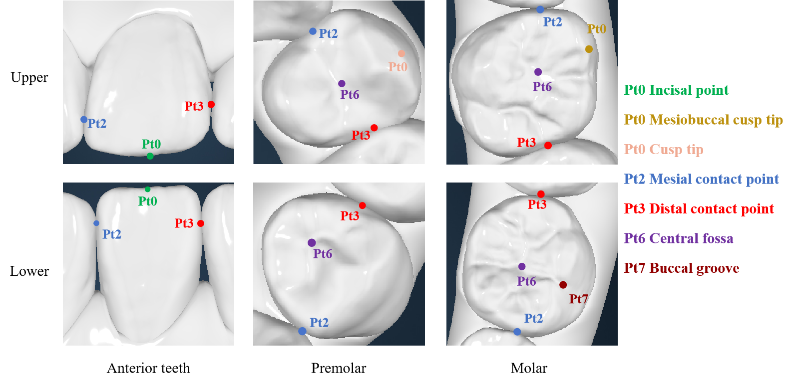 A 3D dental model dataset with pre/post-orthodontic treatment for ...
